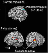 False Negative Emotions | Imbalance of Brain Chemicals
