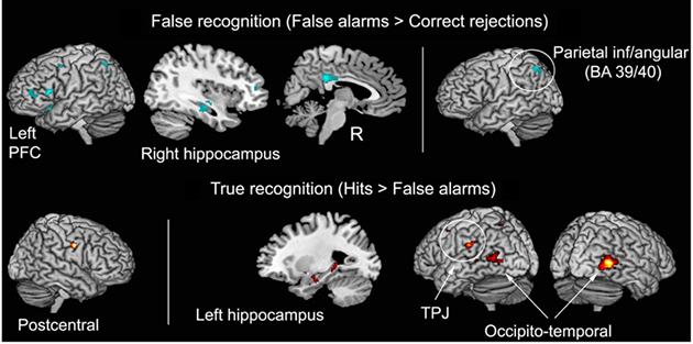 False Negative Emotions | Imbalance of Brain Chemicals